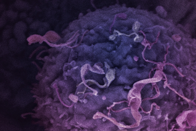 CRISPR/Cas9-engineered Immortalized Breast Epithelial MCF10A Reporter ...
