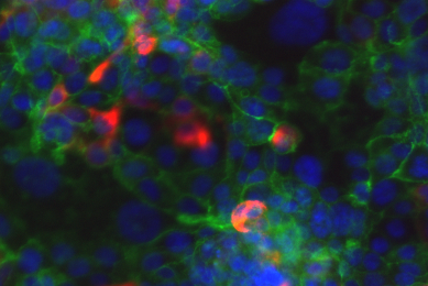 EMT and MET reporter cell lines: Elevating biological models of ...