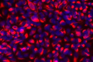 The Generation of a NSCLC EMT Reporter Cell Line for Metastatic Lung ...