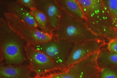 Cell Line Authentication: Protect Your Research and Reputation | ATCC