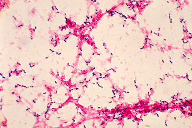 Pneumococcal polysaccharides - tools for research | ATCC